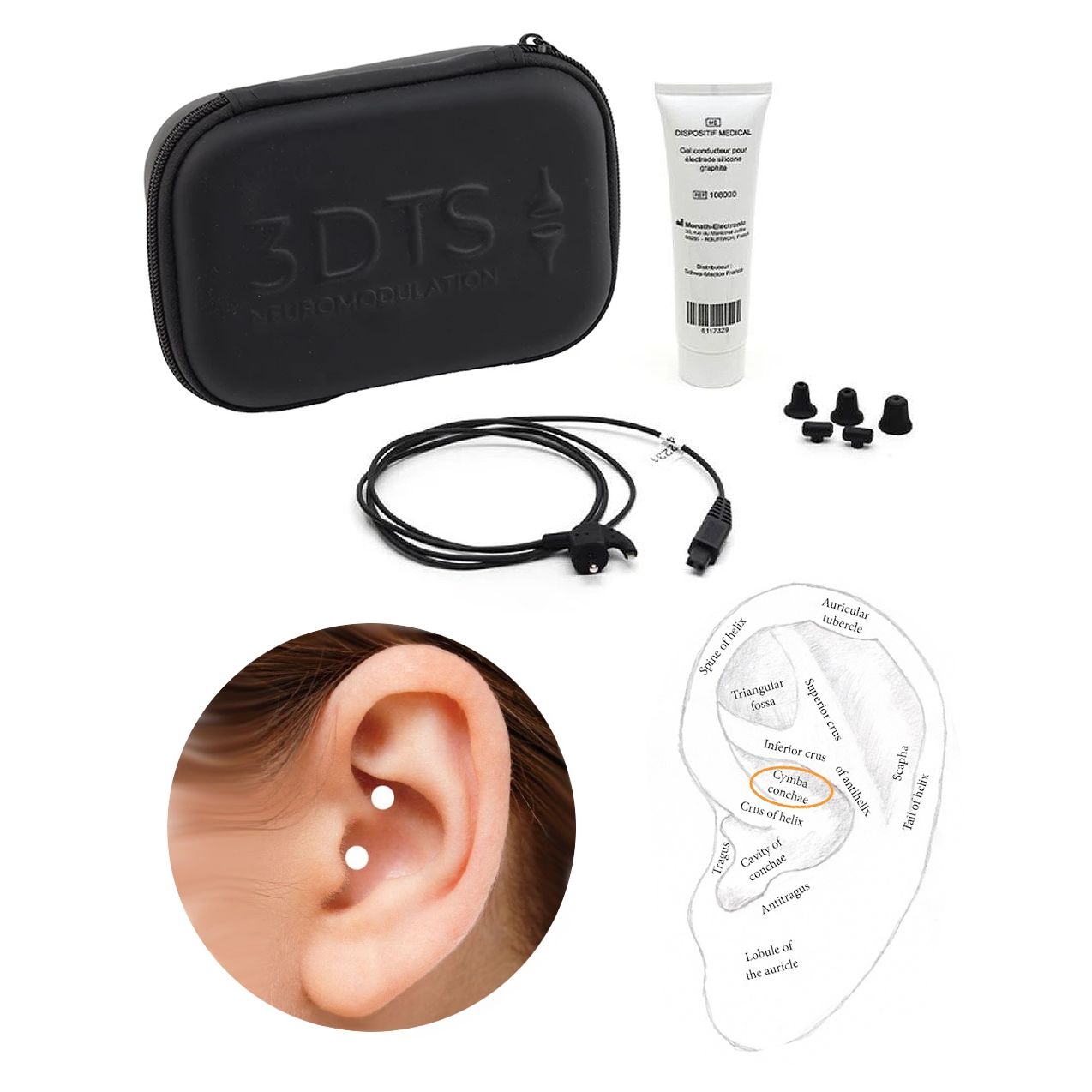 Kit Nerf Vague 3DTS - Cymba Concha - pour électrostimulateur Tens Eco ...